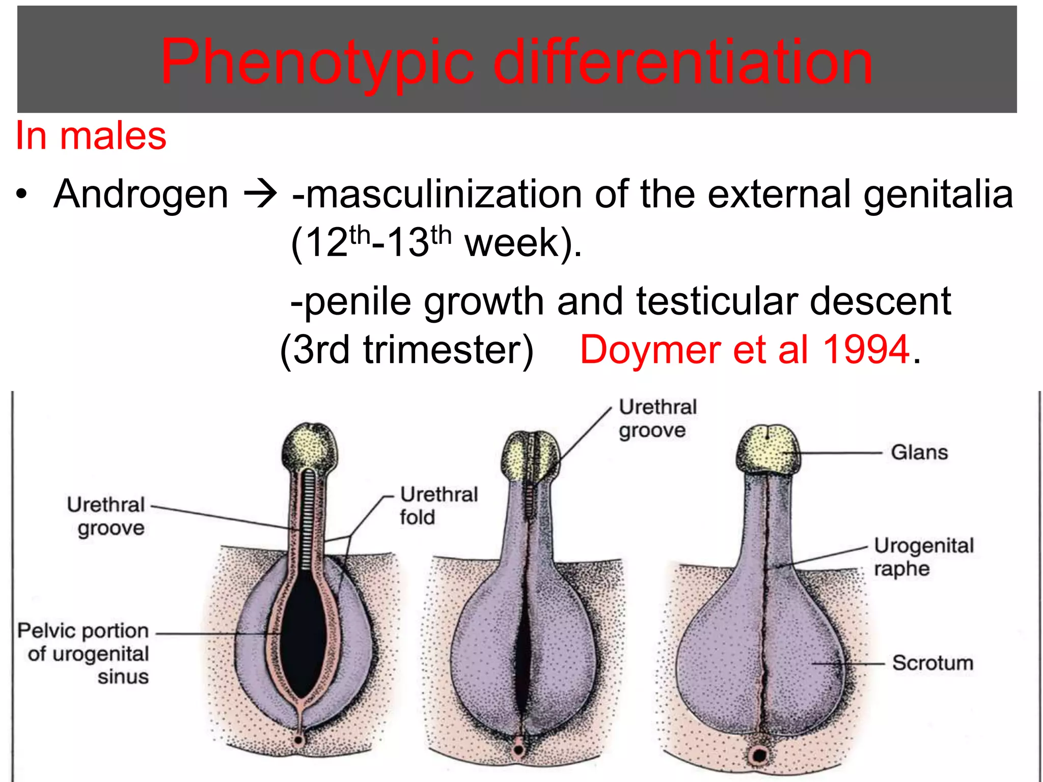 Disorders Of Sex Development Pptx