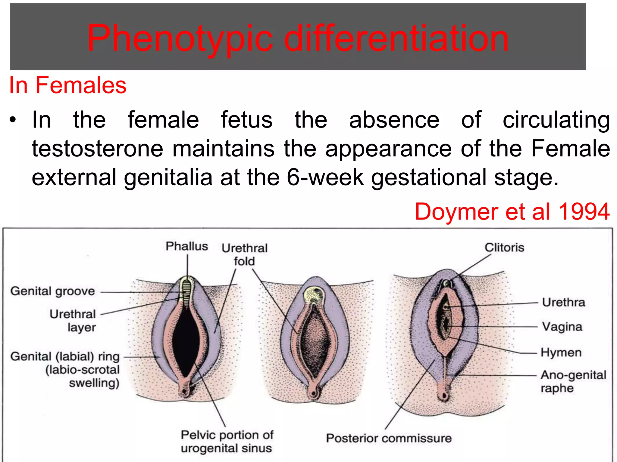 Disorders Of Sex Development Pptx