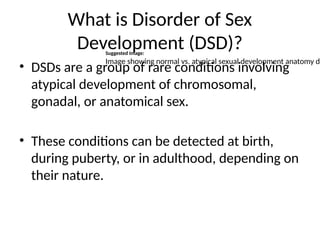 Disorders_of_Sex_Development_Presentation.pptx