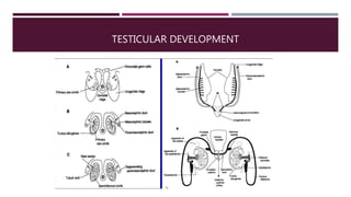 Disorders of sexual development | PPT