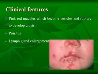 Disorders of skin | PPTX