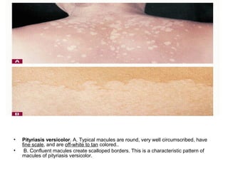 Dermatology 5th year, 3rd lecture (Dr. Ali El-Ethawi) | PPT