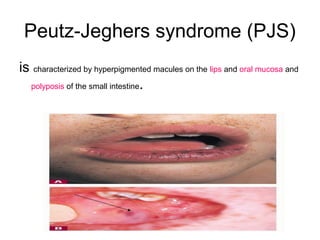 Dermatology 5th year, 3rd lecture (Dr. Ali El-Ethawi) | PPT