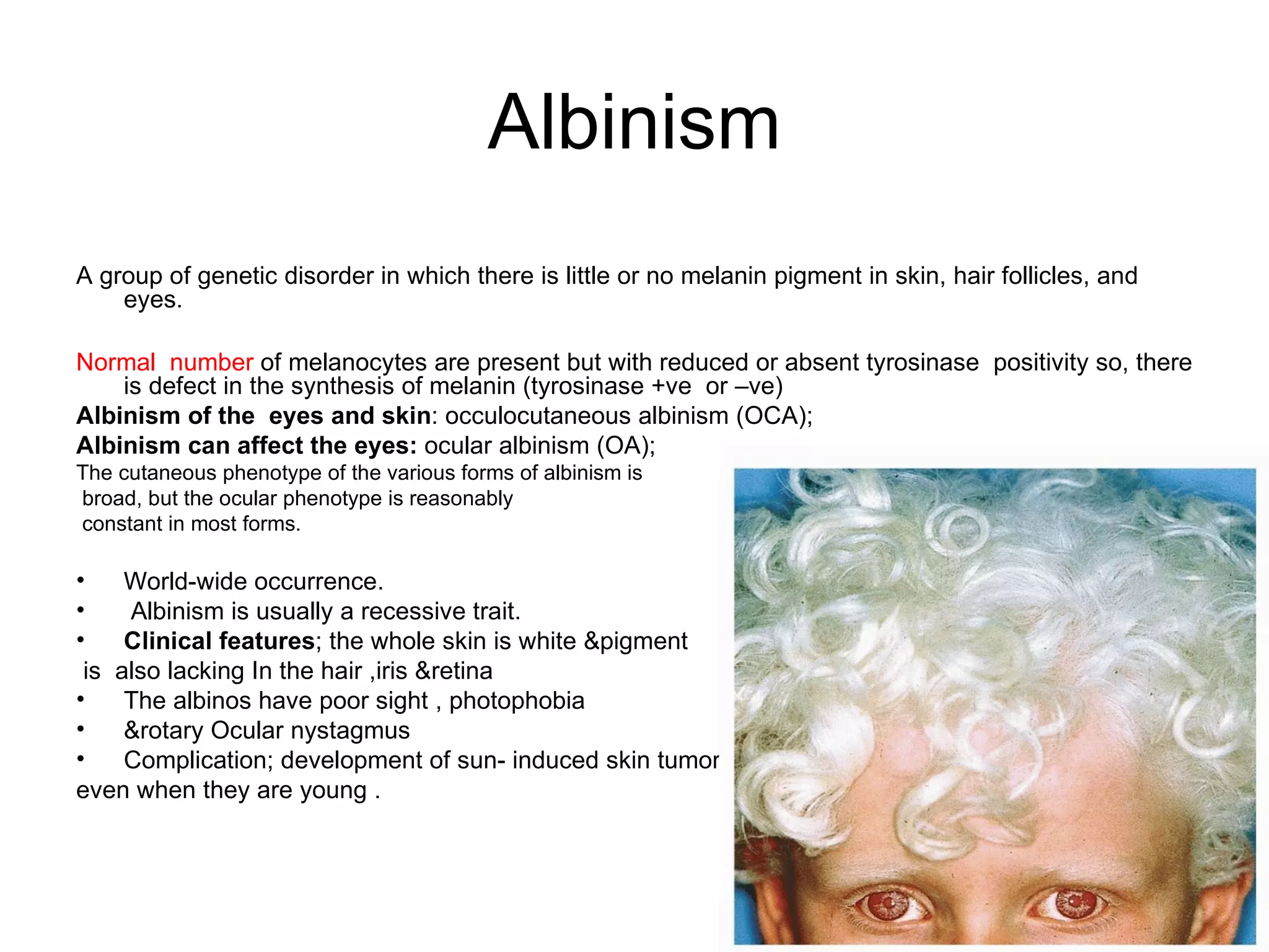 dermatology.Disorders of skin color.(dr.ali) | PPT