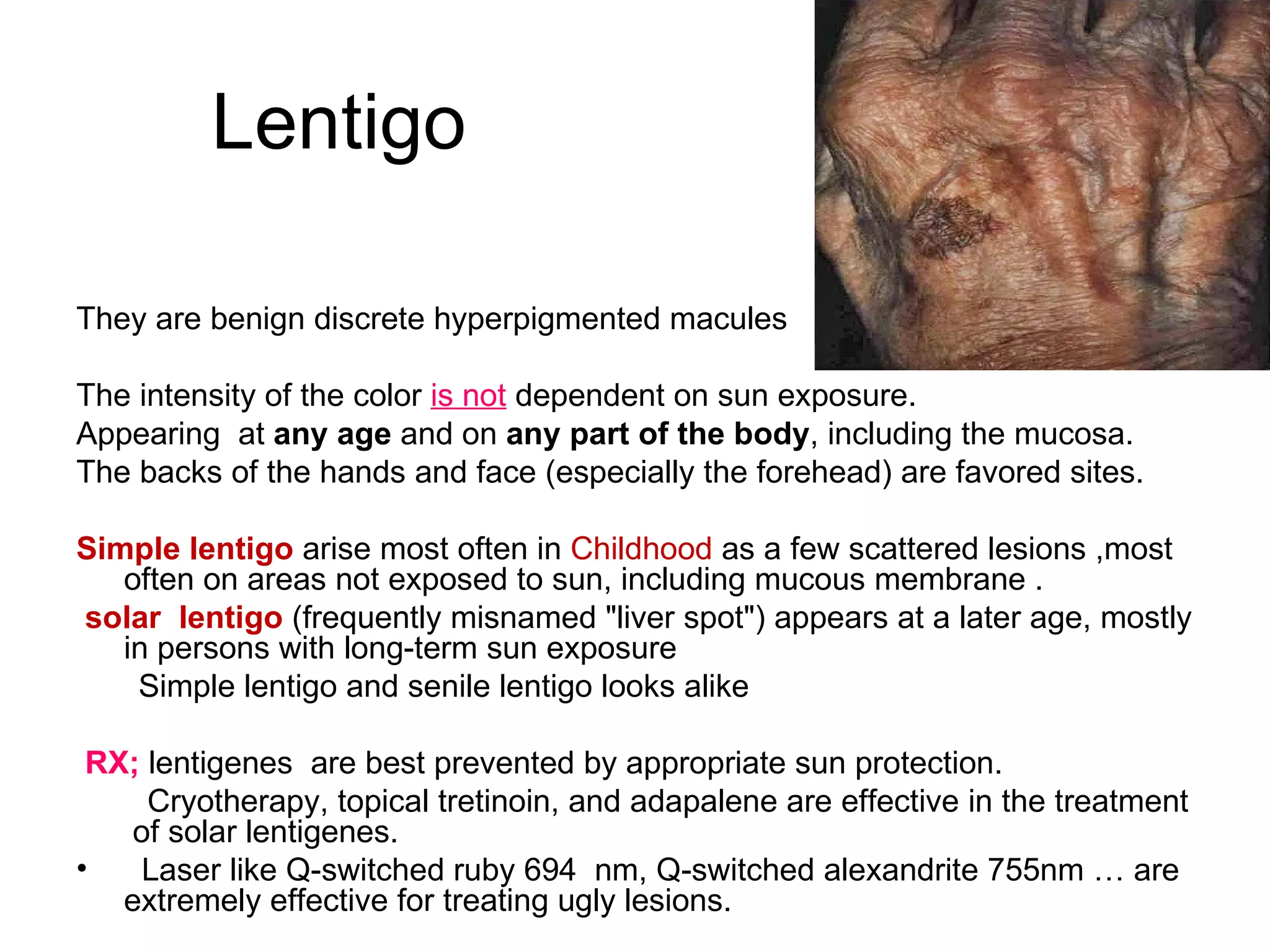 dermatology.Disorders of skin color.(dr.ali) | PPT