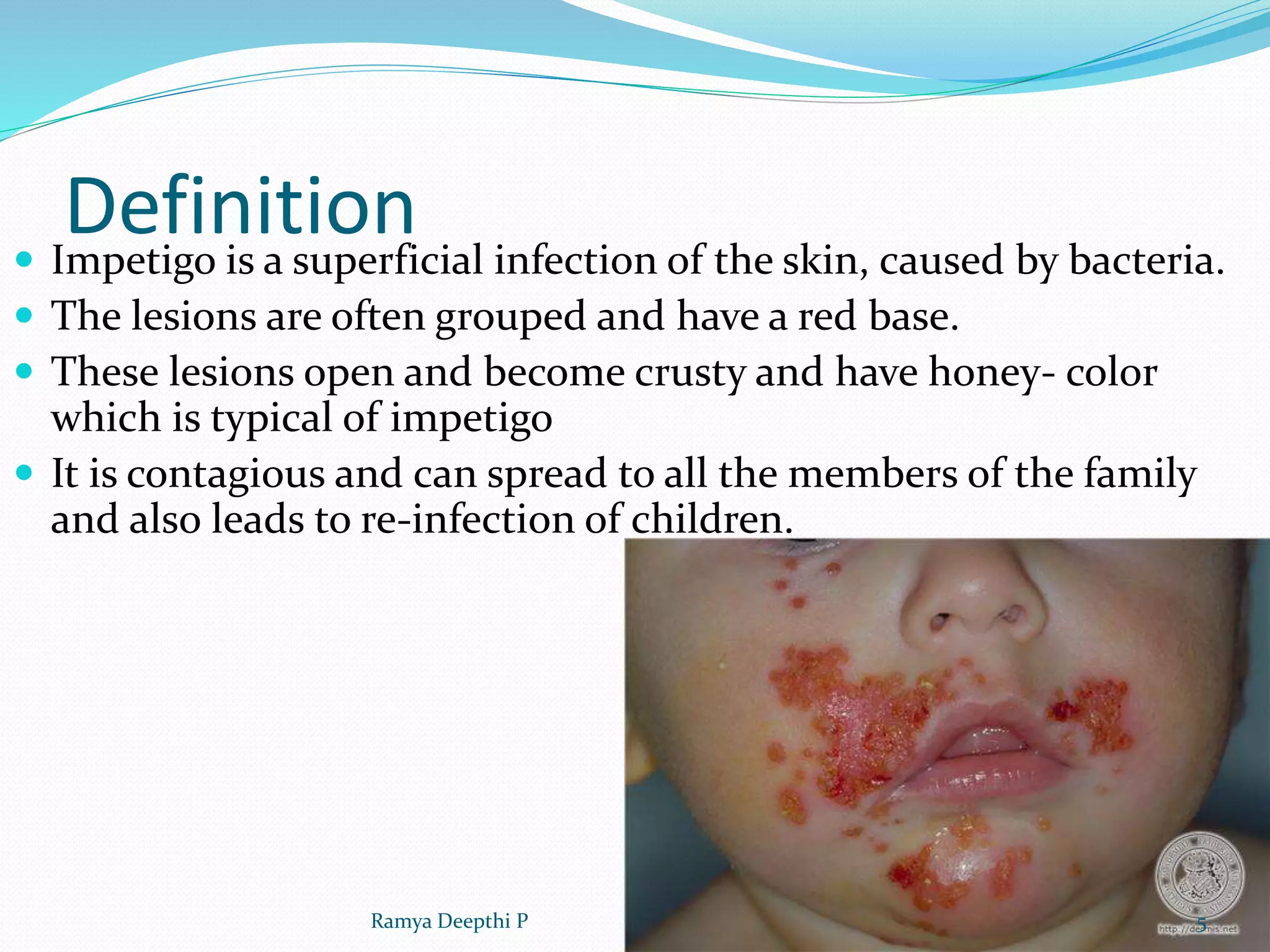 Disorders of skin in children | PPTX