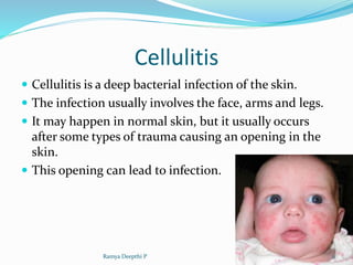 Disorders of skin in children | PPTX