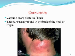 Disorders of skin in children | PPTX