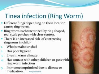 Disorders of skin in children | PPTX | Skin and Dermatology | Diseases ...