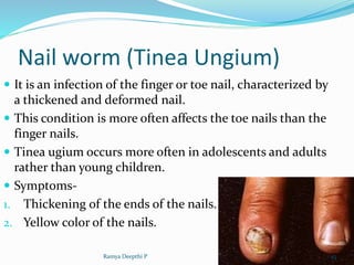 Disorders of skin in children | PPTX