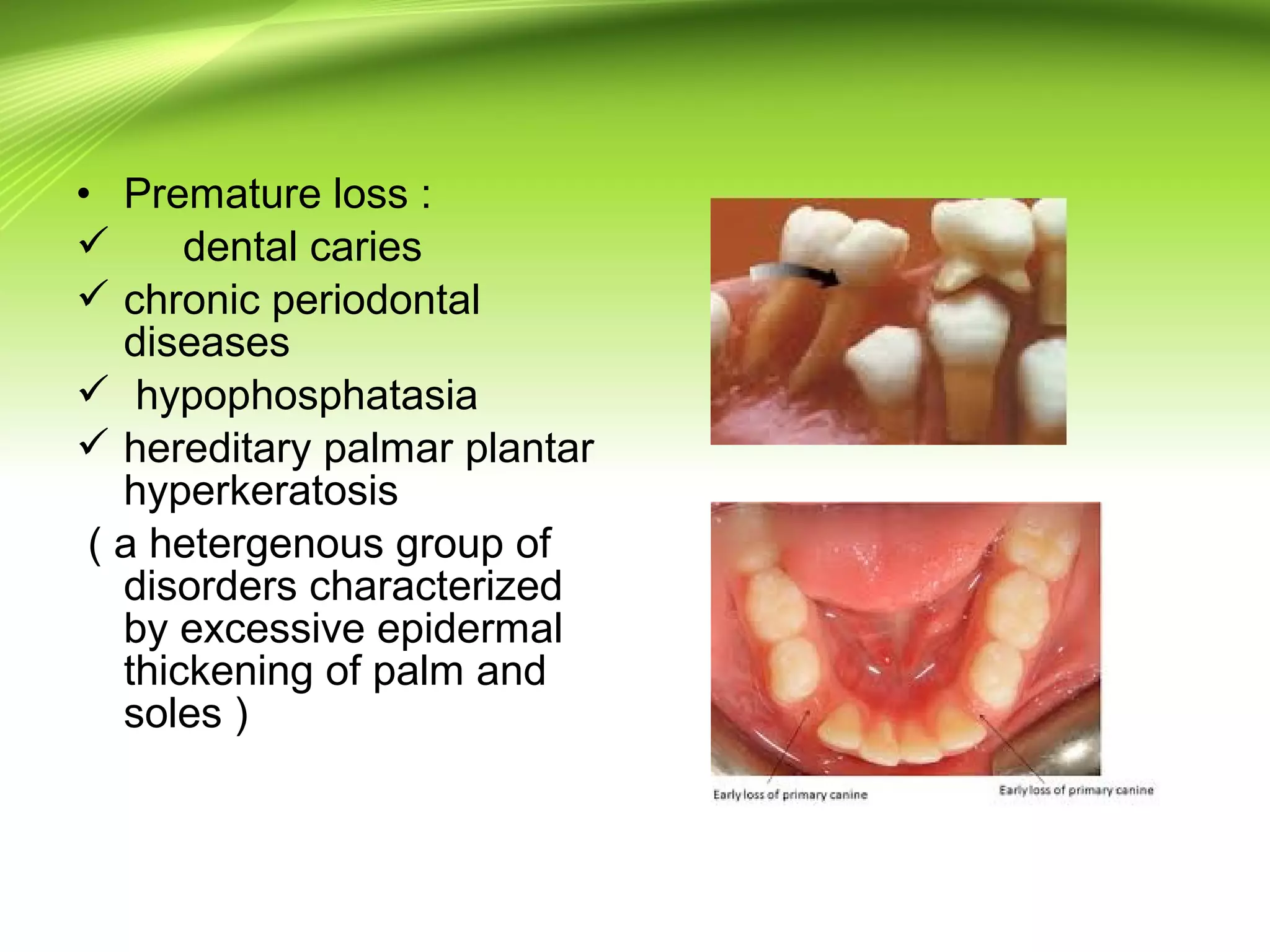 Disorders of teeth | PPT