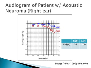 Disorders of the auditory nervous system | PPTX