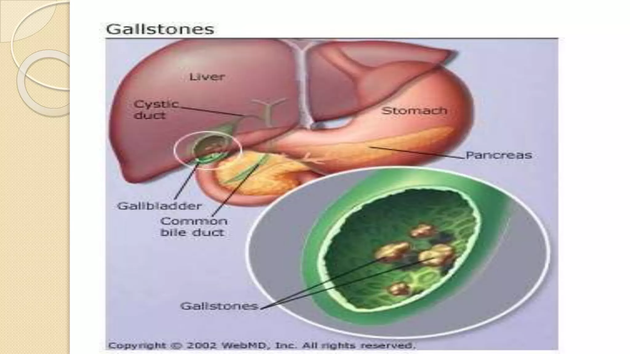Disorders of the biliary tract | PPTX