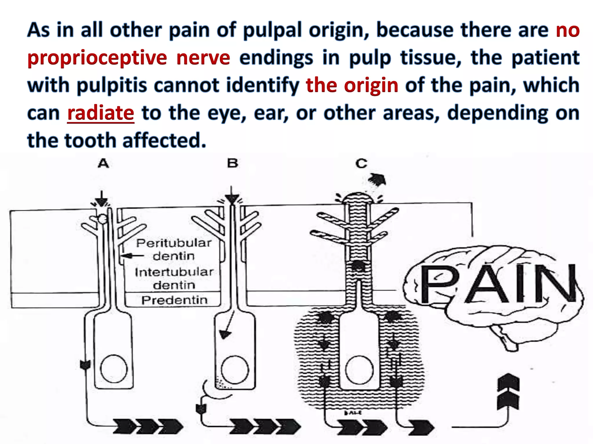 Disorders of the Dental Pulp.pptx