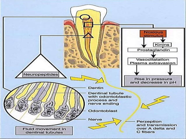 Disorders of the Dental Pulp.pptx | Dental Health | Diseases and Conditions