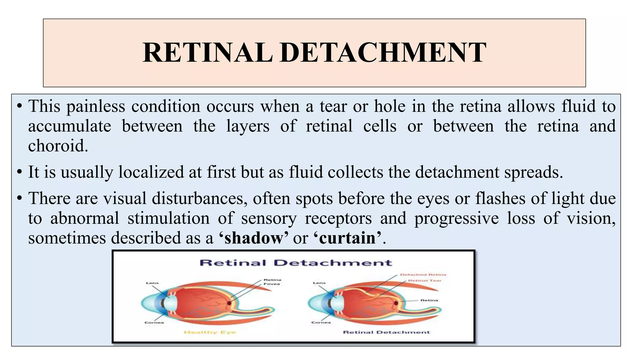Disorders of the eye | PPTX