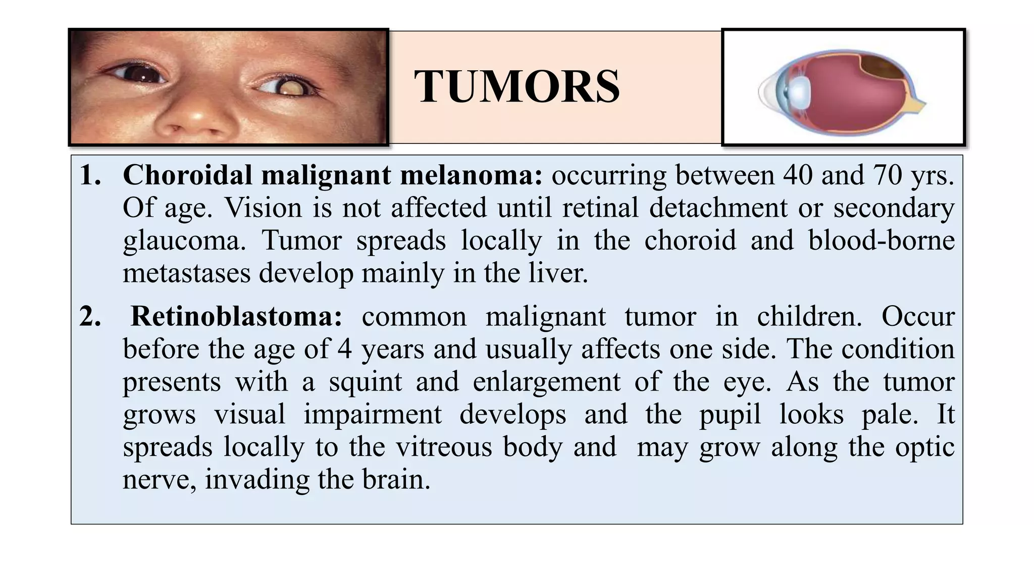 Disorders of the eye | PPTX