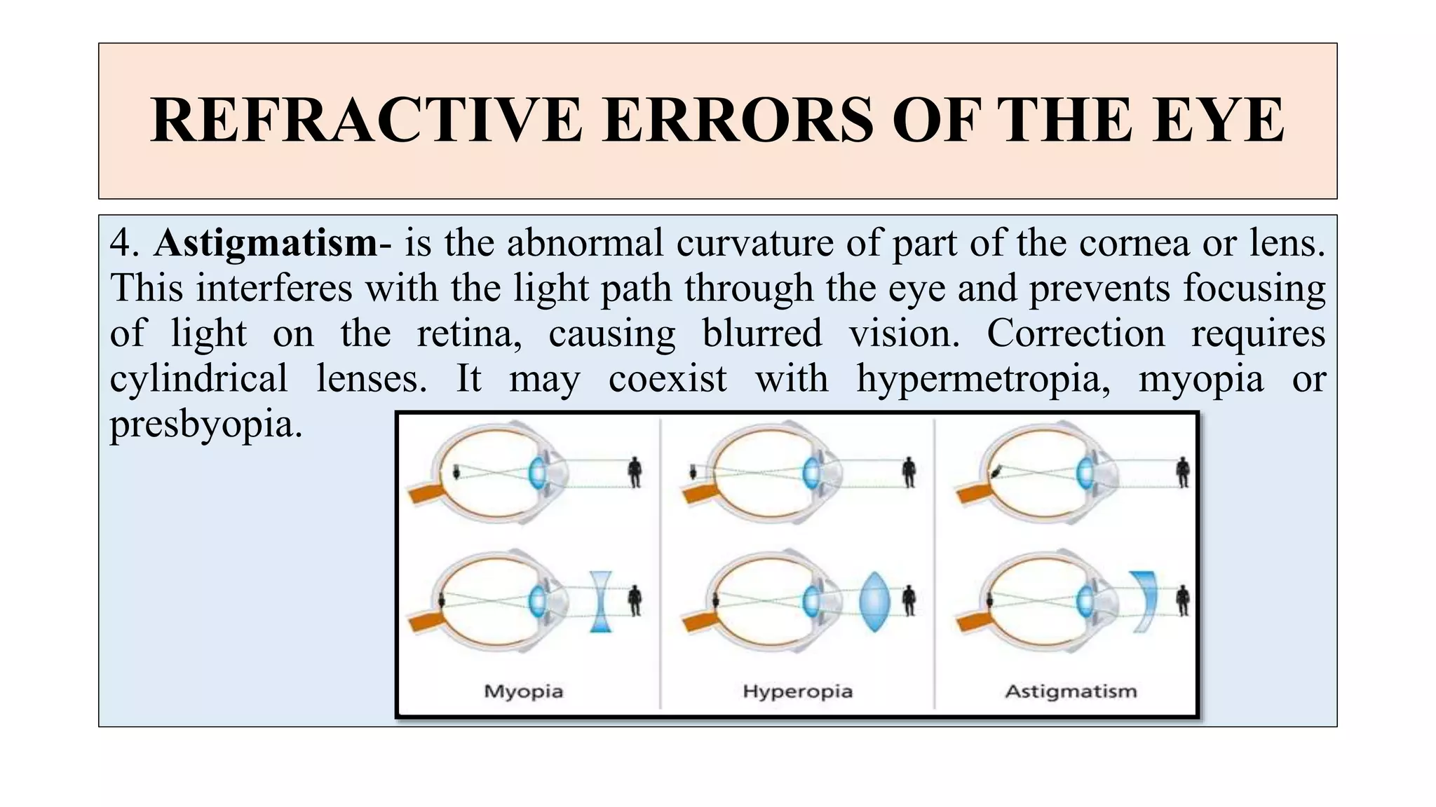Disorders of the eye | PPTX