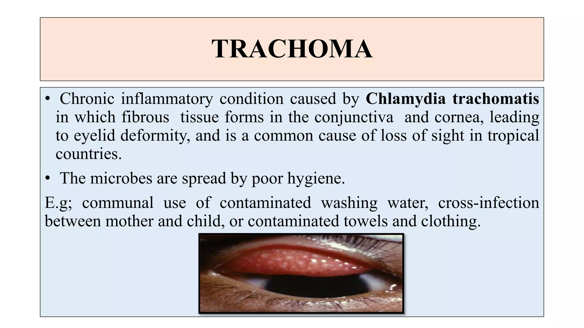 Disorders of the eye | PPTX