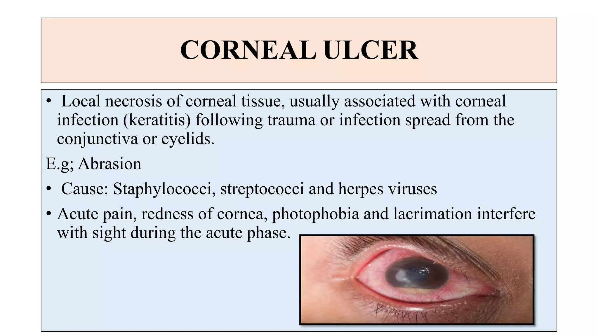 Disorders of the eye | PPTX