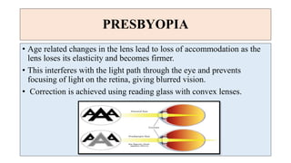 Disorders of the eye | PPTX