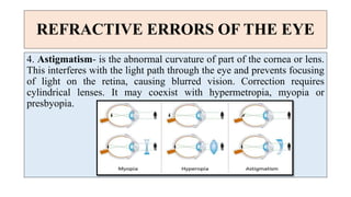 Disorders of the eye | PPTX