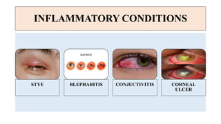 Disorders of the eye | PPTX