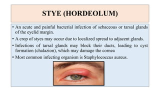 Disorders of the eye | PPTX