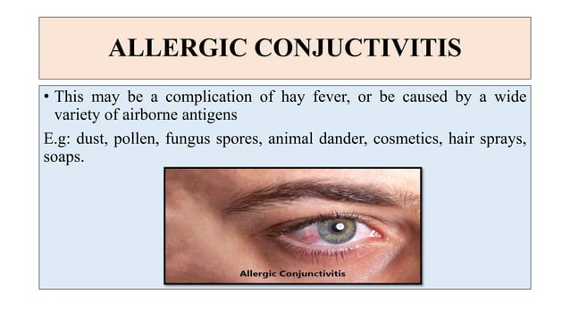 Disorders of the eye | PPTX