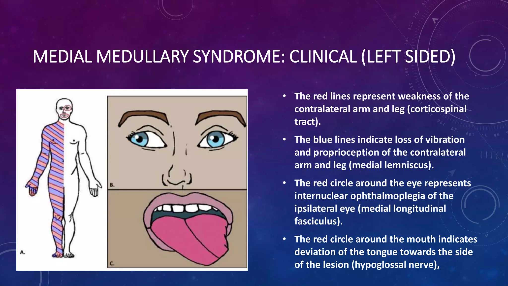 Disorders of the hypoglossal nerves | PPTX