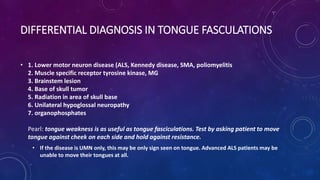Disorders of the hypoglossal nerves | PPTX