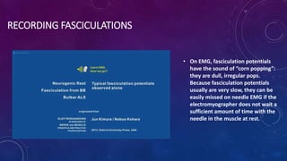 Disorders of the hypoglossal nerves | PPTX