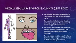 Disorders of the hypoglossal nerves | PPTX