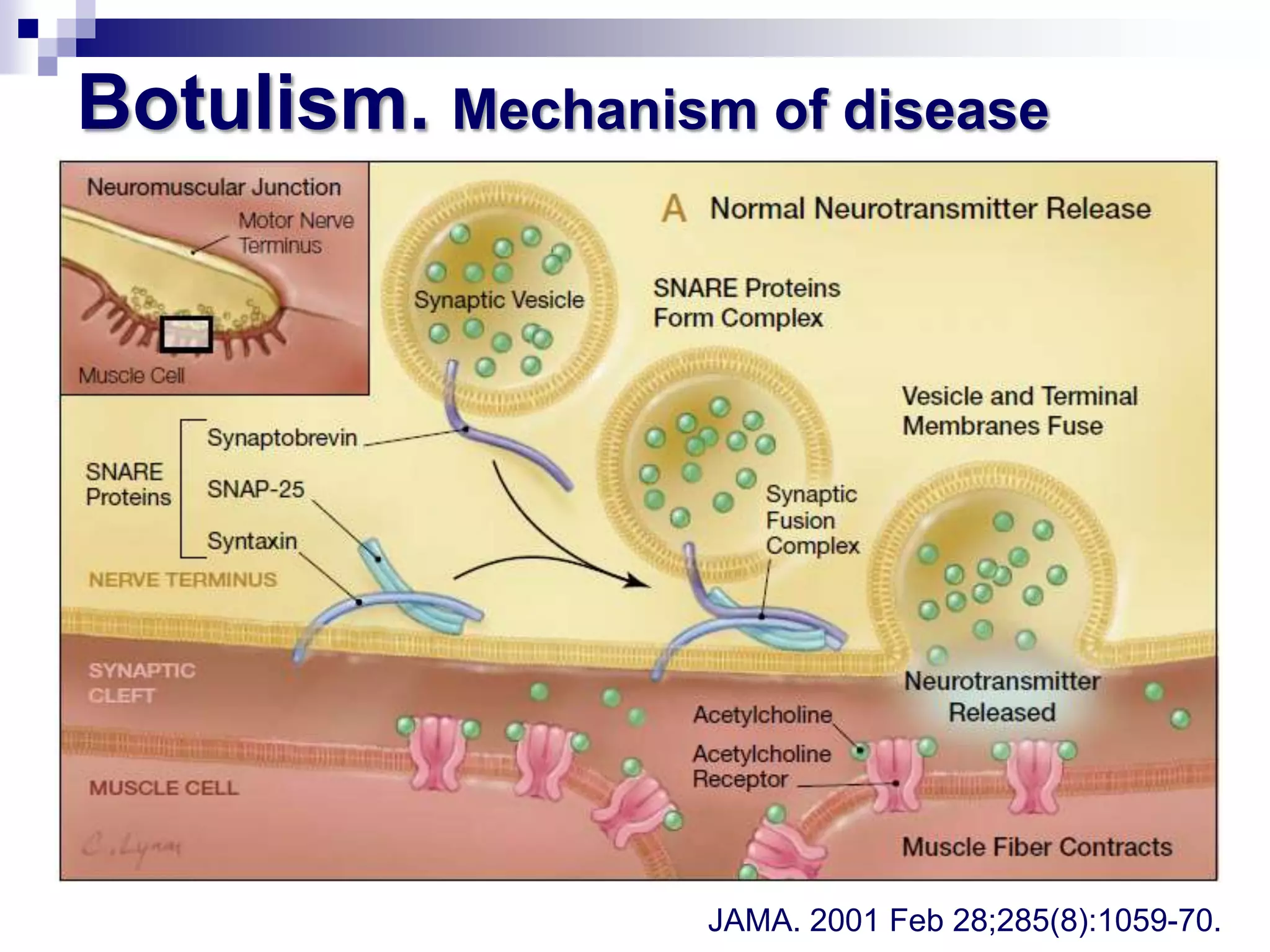 Disorders of the neuromuscular junction | PPTX