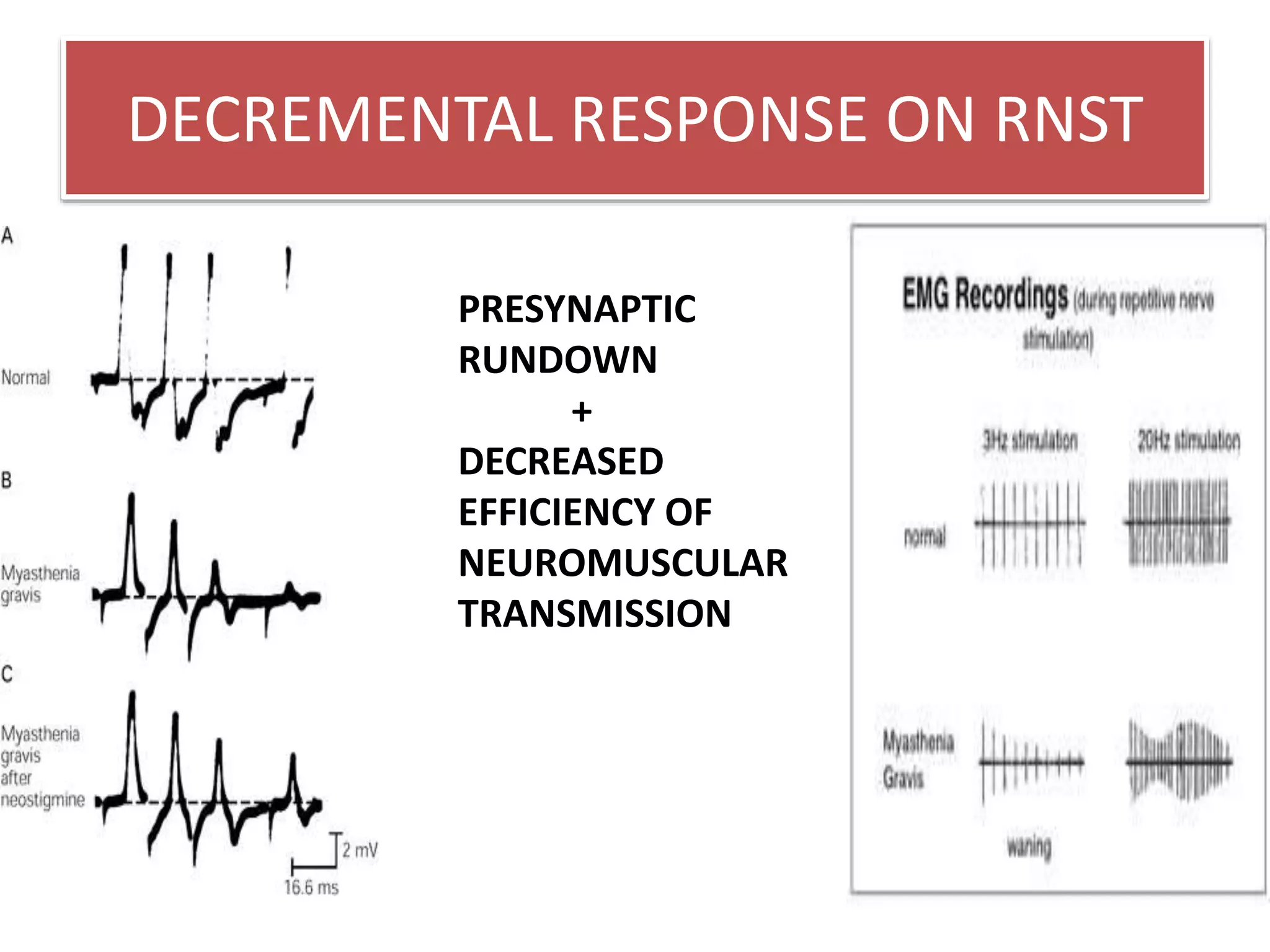 Disorders of the Neuromuscular junction | PPTX