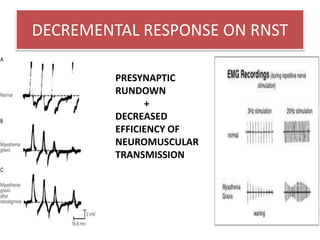 Disorders of the Neuromuscular junction | PPTX