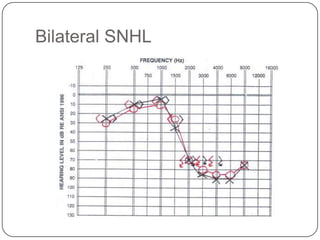 Disorders of the peripheral auditory system | PPTX
