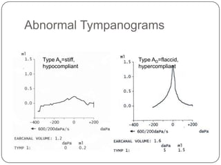 Disorders of the peripheral auditory system | PPTX