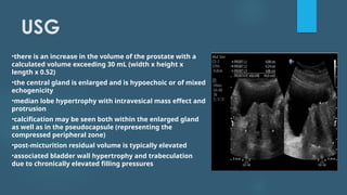 DISORDERS OF THE PROSTATE GLAND Radiology | PPTX