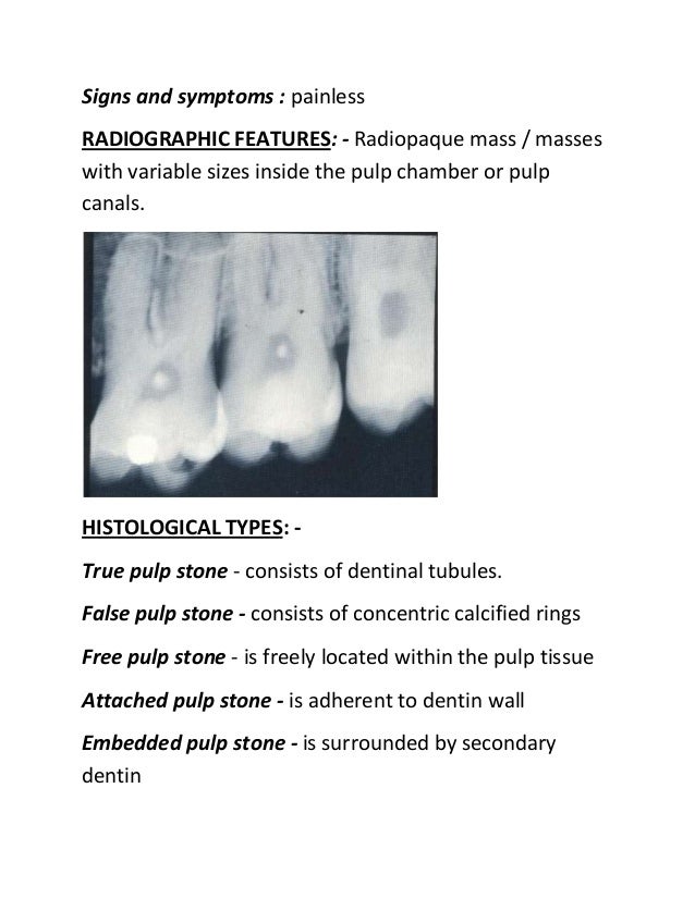 Disorders of the pulp