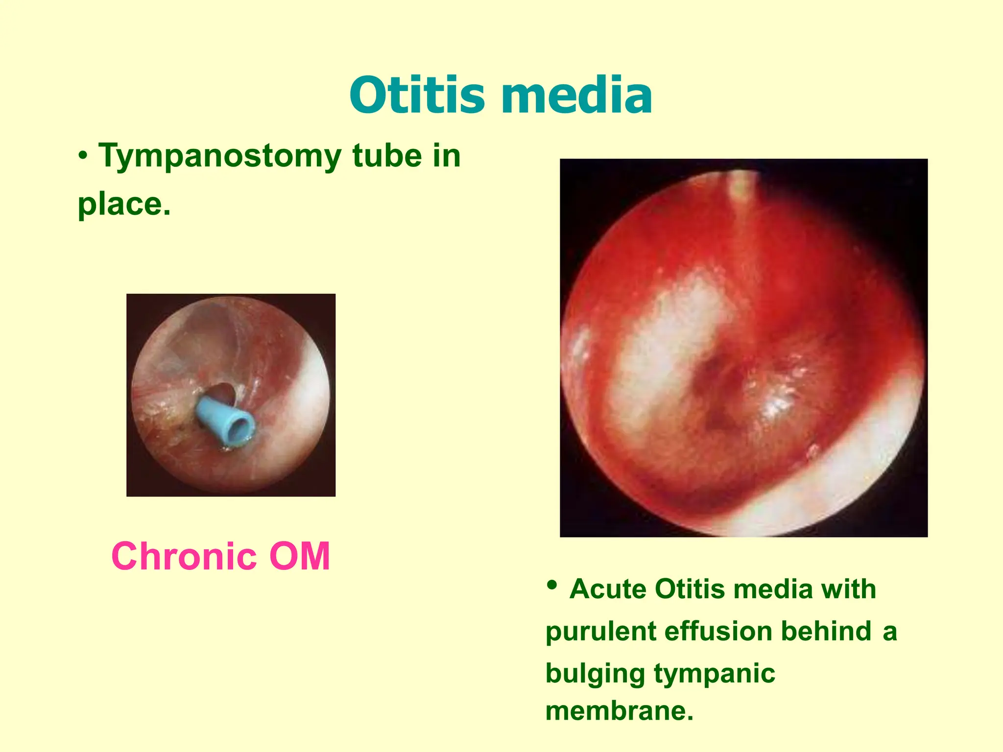 Nursing care of family with respiratory disorders of the respiratory ...