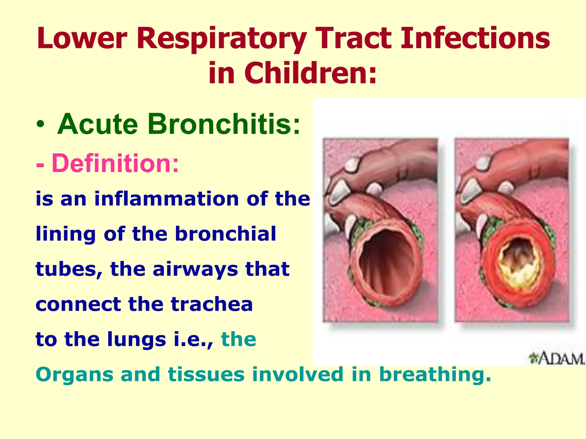 Nursing care of family with respiratory disorders of the respiratory system.ppt