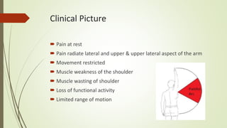 Disorders of the shoulder joint | PPTX