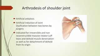 Disorders of the shoulder joint | PPTX