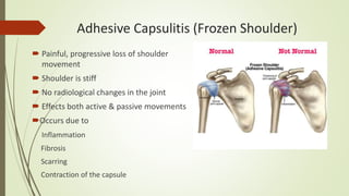 Disorders of the shoulder joint | PPTX