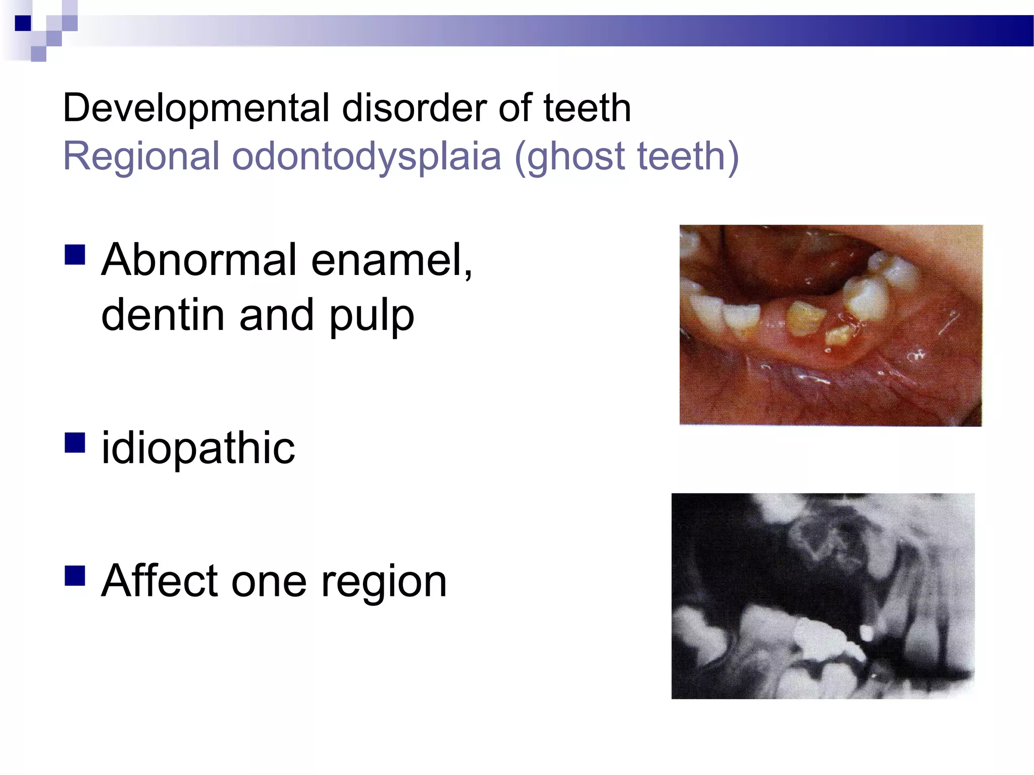 Disorders of the teeth & bone | PPT