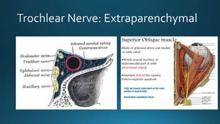 Disorders of the trochlear nerve | PPTX | Brain and Nervous System ...