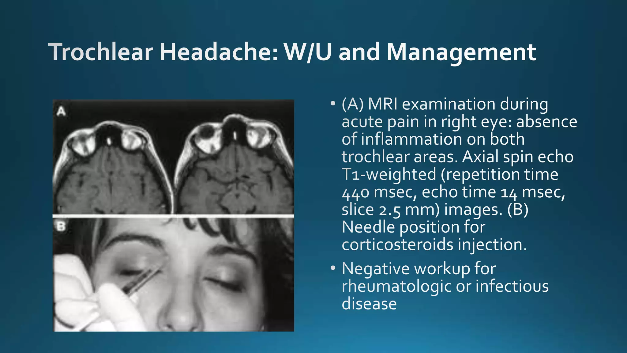 Disorders of the trochlear nerve | PPTX