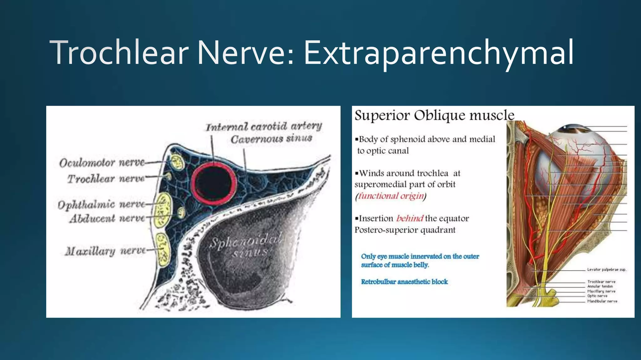 Disorders Of The Trochlear Nerve Ppt