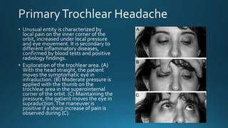Disorders of the trochlear nerve | PPT
